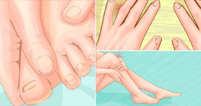 Polyarthrite rhumatoïde : Définition, symptômes et itratements